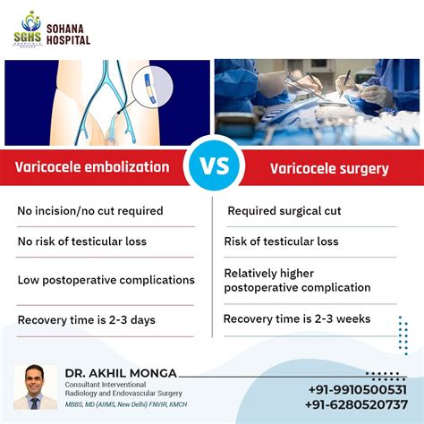 Varicocele Surgical And Embolization For Scrotum Vein Dr Akhil Monga Posted On The Topic