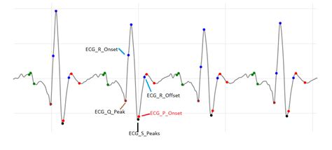 incorrect edges of peak waves · issue 761 · neuropsychology neurokit