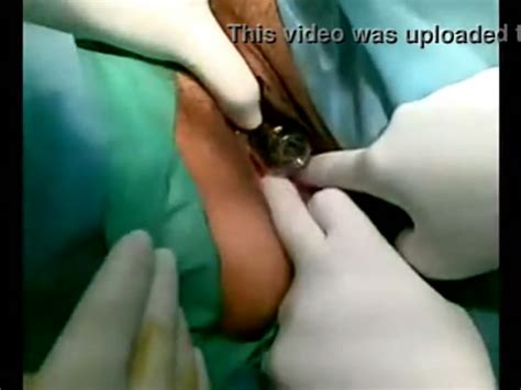 Get Foreign Objects In The Hospital