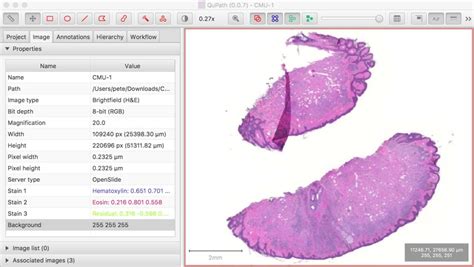 Preprocessing · Qupathqupath Wiki · Github