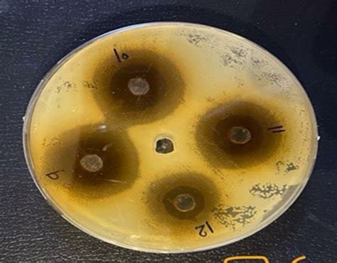 Shows The Antimicrobial Activity Of Aqueous Clove Seeds Extract On The