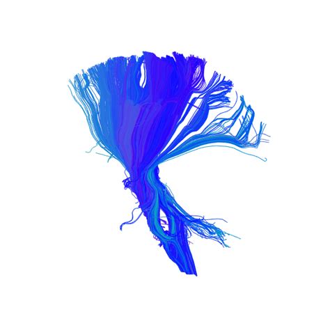 Automatic Fiber Bundle Extraction With Recobundles — Dipy 1 11 0 Documentation