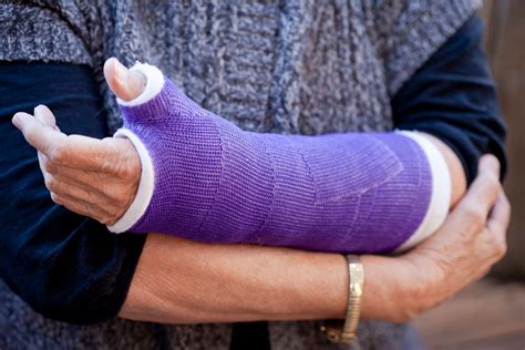 Broken Leg Service In Miranda Shire Fracture Clinic