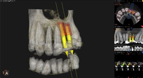 Dental Dental 3d Ct Scans At Market Place Dentistry Thirsk