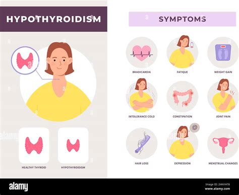 Hypothyroidism Disease Symptoms Infographic With Woman Character Underactive Thyroid Gland