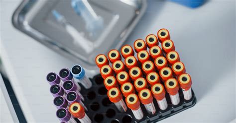 흰색 표면에 서 있는 의료용 실험 액체가 있는 바이알의 평면도 사진 Unsplash의 유리병 이미지