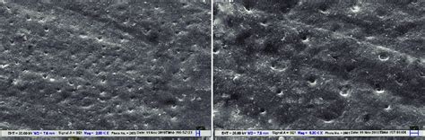 Scanning Electron Microscopy Photomicrograph Of Dentin Surface Treated