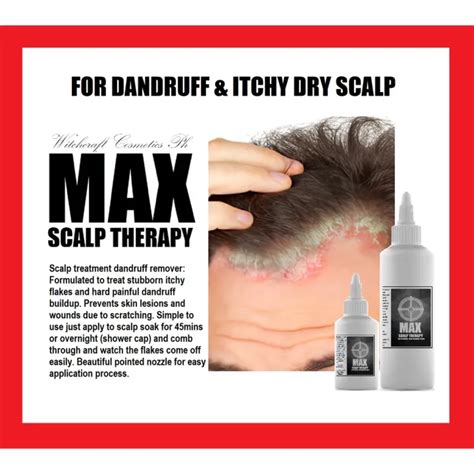 Max Scalp Dandruff Psoriasis Care Scalp Treatment Cooling Peppermint For Tough Flakey Itchy