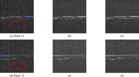 Deep Learning For Unsupervised Denoising Of Radar Sounder Data Semantic Scholar
