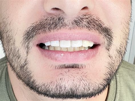 ‎دکتر سمیه بینافر‎ Drsomayebina • Instagram Photos And Videos