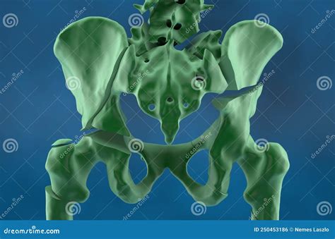Fractured Pelvis Femur And Spine In Osteoporosis Isometric View 3d Illustration Stock