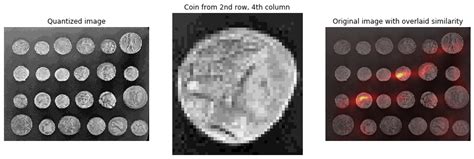 Introduction To Scikit Learn And Scikit Image — Mri Analysis In Python