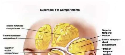 整形外科王晓阳医生 的想法 前额中央脂肪间隔和前额中间脂肪间隔：许… 知乎