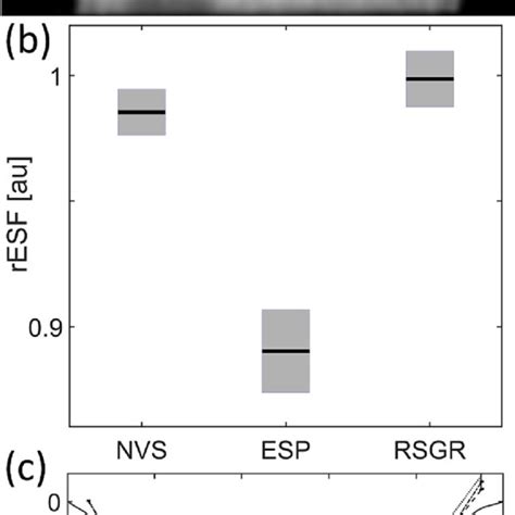 Comparison Of Reconstruction Techniques Demonstrating Spatial Download Scientific Diagram