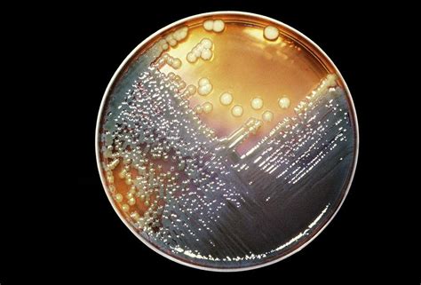 Cultured Enterobacter Bacteria Photograph By Science Photo Library Pixels