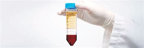 Cell Separation And Cell Isolation Techniques Methods Applications