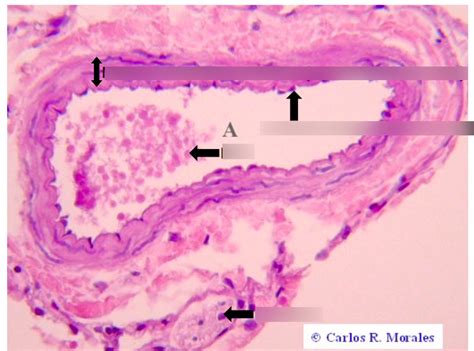 Lab 6 Arteriole In Cross Section Diagram Quizlet