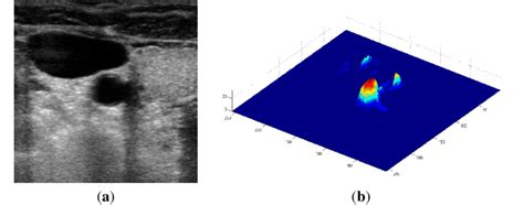 A Original Image And B Saliency Map After Applying Fast Radial Download Scientific Diagram