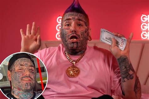 Most Modified Man In The World Splits His Hand In World First