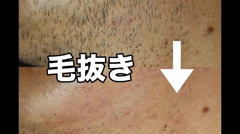 20 首の毛を抜く Tweeze Facial Hair Youtube