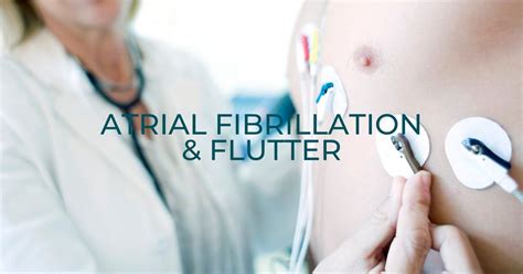 Atrial Fibrillation Flutter What You Need To Know Pulse Cardiac Health