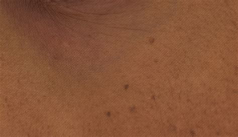 Female 089 Albedo Map