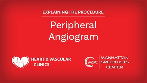 Explaining The Procedure Peripheral Angiogram Youtube