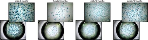 Sex And Age Related Differences In Cellular Senescence Of Cardiac Download Scientific Diagram
