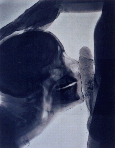 Rule 34 Tagme X Ray 881267