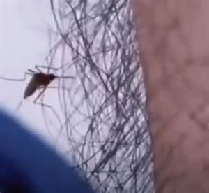 털에 걸려 피 볼 수도모기는 털난 사람을 싫어해 아시아경제