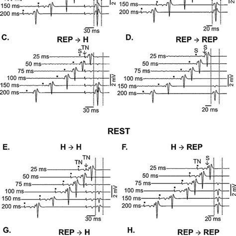Pdf Post Activation Depression In The Human Soleus Muscle Using Peripheral Nerve And