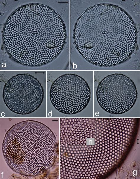 A F Coscinodiscus Radiatus Valves In Different Focal Views G H C