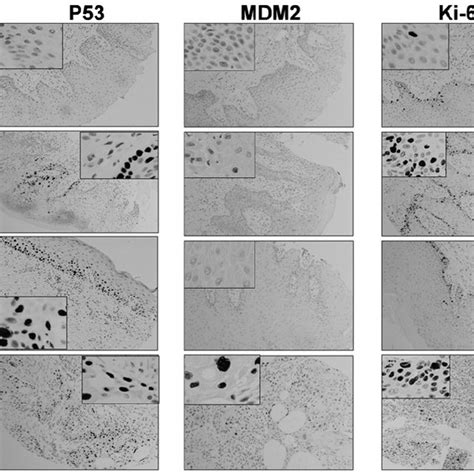Expression Of P16 Prb Senescence Pathway Markers Cyclin D1 And Rb And Download Scientific