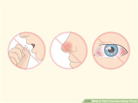 How To Tell If You Have Strep Throat With Pictures WikiHow