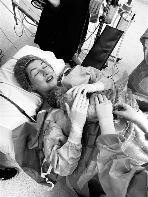 C Section Recovery Week By Week The Must Have Recovery Tips