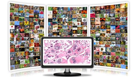 8 Free Open Source Software Programs For Pathology Image Analysis