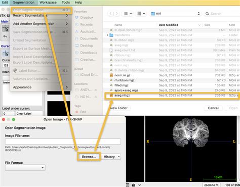 ITK Snap Tutorial The ITK Snap GUI Andy S Brain Book Documentation