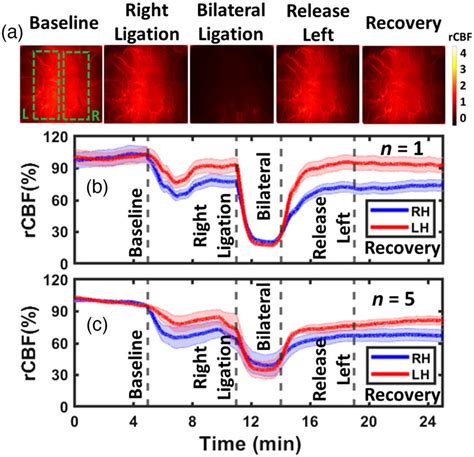 Dsct Measurements Of Rcbf Responses To Sequential Unilateral And Download Scientific Diagram