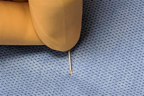 Fluoroscopic Guided Knee Joint Injection Technique And Overview The Procedure Guide