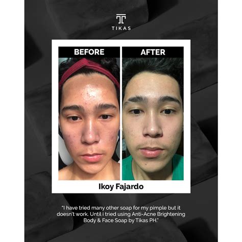 Tikas Niacinamide Body And Face Soap [set Of 2]