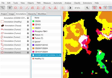 In A Qupath Overlay Can You Hide Or Show Individual Pixel Classes