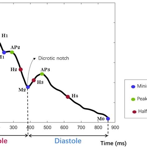 Main Representative Points Of The Arterial Flow Waveform Example Of An