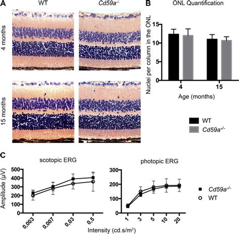Retinal Function And Morphology Of Aged Cd59a−− Mice Seem To Be Not