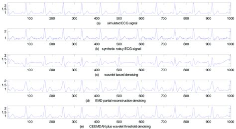 Synthetic Noisy Ecg Simulated Ecg Signal De Noising Results Download Scientific Diagram
