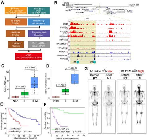 Enhancer Rna Promotes Resistance To Radiotherapy In Bone Metastatic Prostate Cancer By M6a