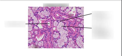 Bio 169 Lab Exam 3 Photomicrographs Pt 2 Diagram Quizlet