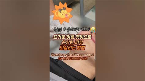 휴가철 손상된 피부 살리는 법 피부관리 피부재생 줄기세포시술 줄기세포얼굴주사 Youtube