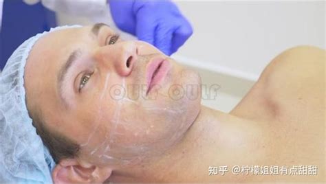 脸部超声刀的危害和副作用超声刀后皮肤更松弛了太糟心了吧 知乎