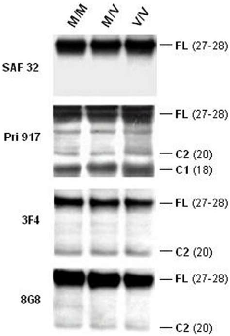 Comparative Biochemical Analysis Between Brain And Pbmcs A