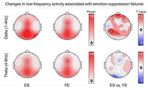 Low Frequency Eeg Activity Associated With Emotion Suppression Download Scientific Diagram